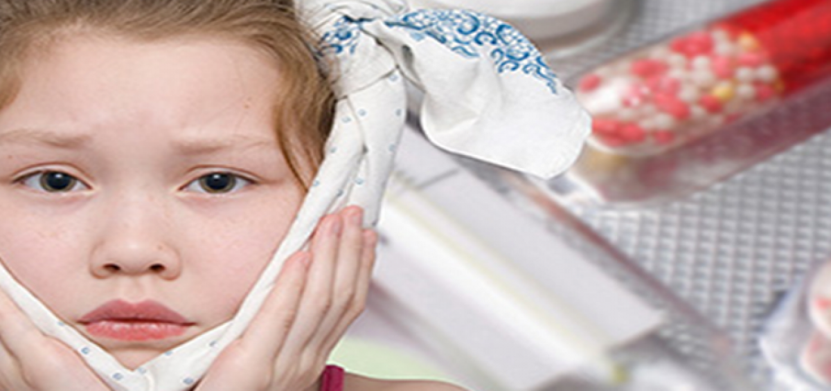 Tudo que você precisa saber sobre a caxumba | AlphaImune