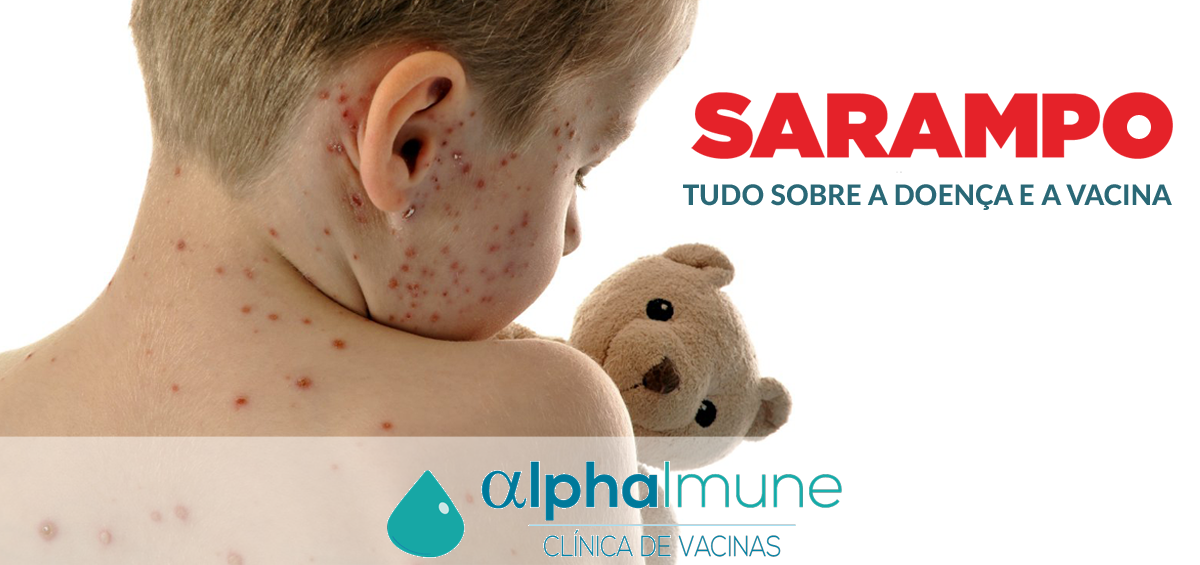 Sarampo tudo sobre a doença e a vacina. | AlphaImune